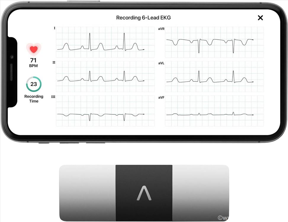 AliveCor KardiaMobile 6L Mobilni EKG Monitor | Halo Oglasi