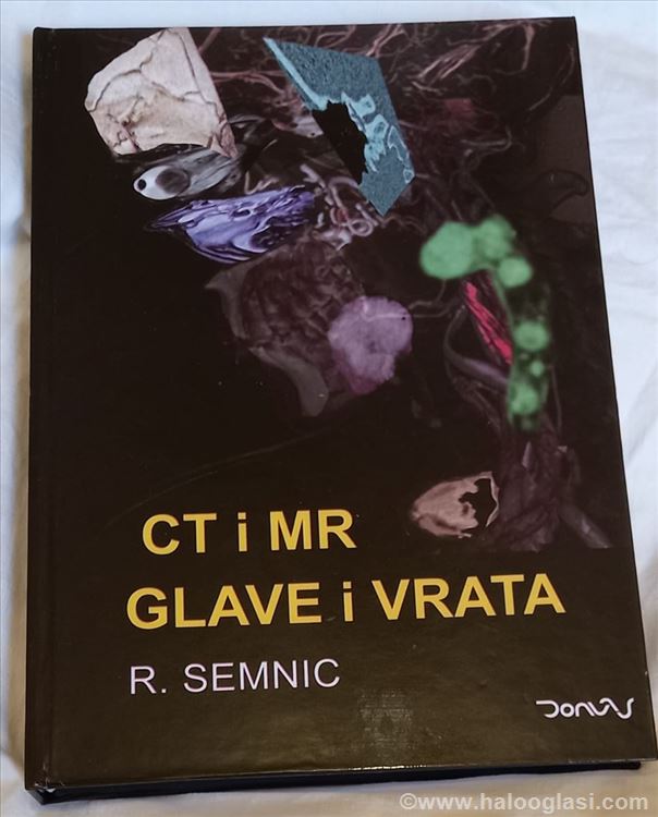 CT i MR glave i vrata ,Semnic | Halo Oglasi